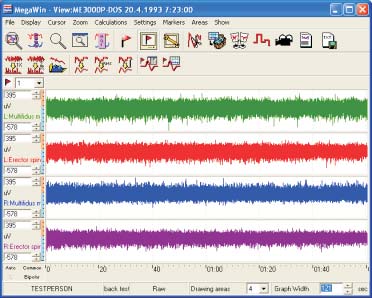 ME6000 8/16 Kanallı Kablolu/Kablosuz EMG Sistemleri | Data Teknik ...
